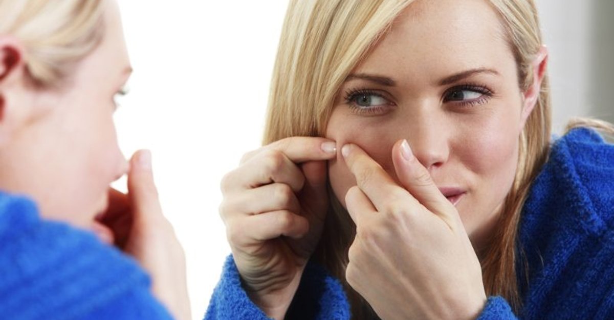 Cum tratăm coșurile de pe față! Uite câteva soluții