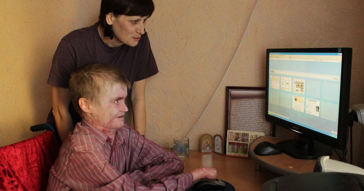 Expoziție de fotografie despre boala fluturelui, lângă monumentul lui ...