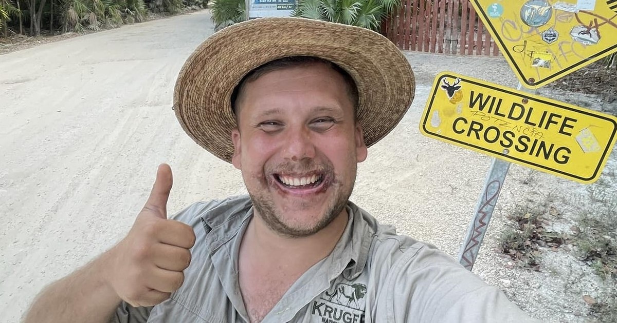 Bărbatul care s-a ales cu arsuri de gradul trei pe faţă, după ce a ...