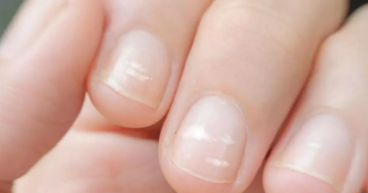 Aspectul unghiilor poate indica probleme de sănătate. Despre ce ...
