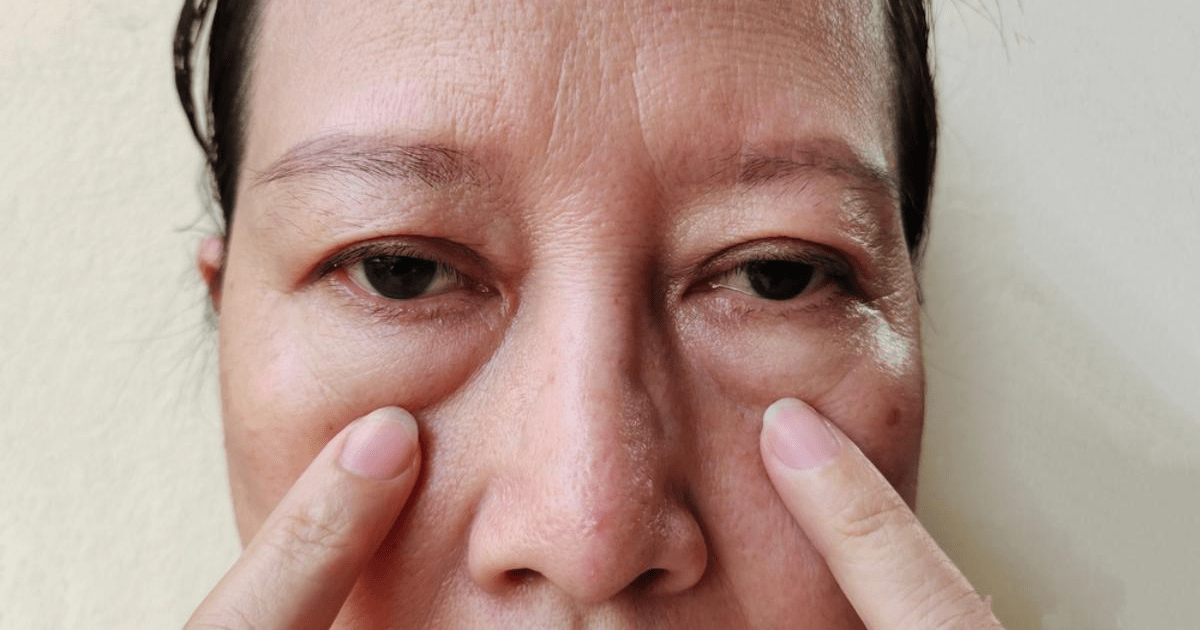 5 simptome ale bolii rinichilor, vizibile pe față și pe gât