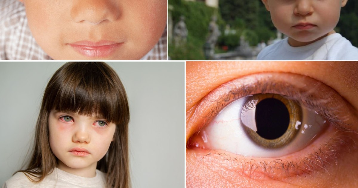 Privirea copilului tău îți poate spune mai multe decât crezi: ce boli ...