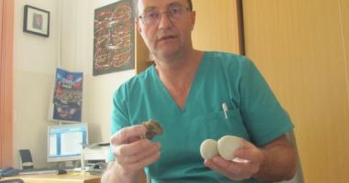 Medicul Nicolae Grigore colecţionează pietre extrase din rinichii ...