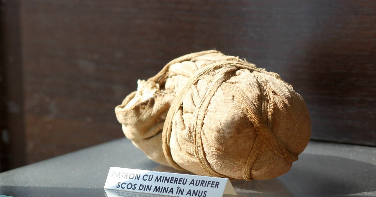 Bulgărele uriaș de aur scos din corpul unui miner ascunde un secret ...