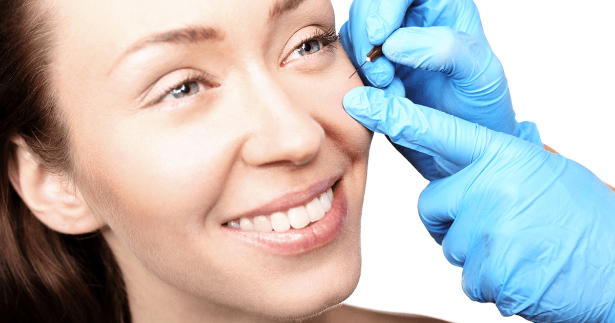 Ce să știi despre milia, punctele de grăsime de sub piele