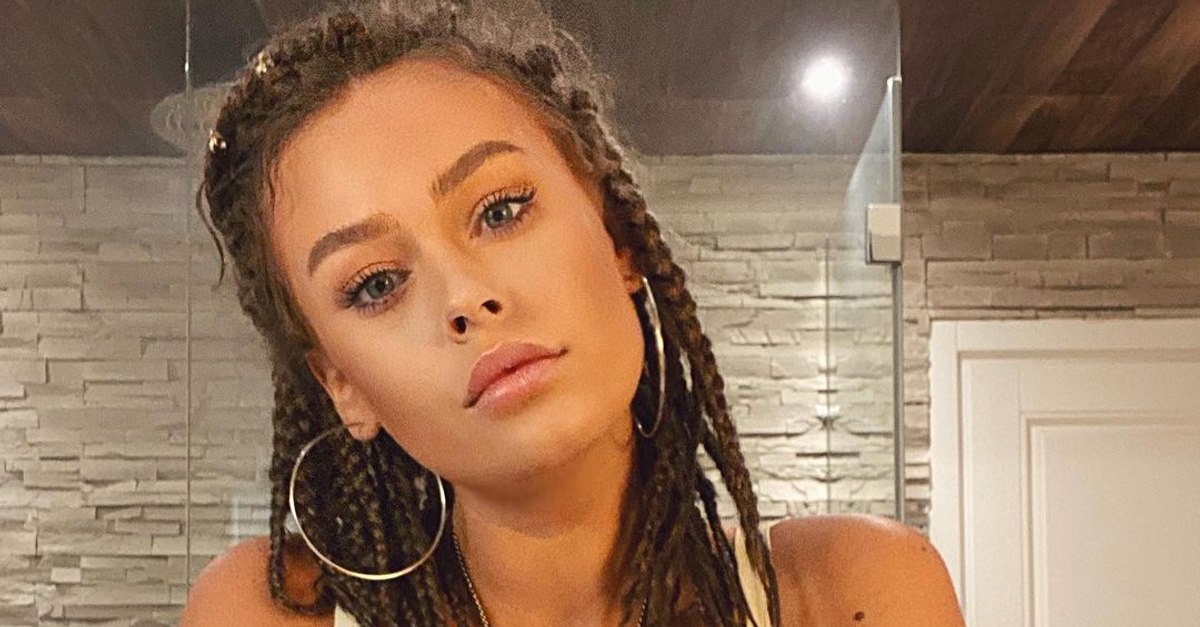 Ce a pățit la față fosta soție a lui Connect-R. Misha e de nerecunoscut ...