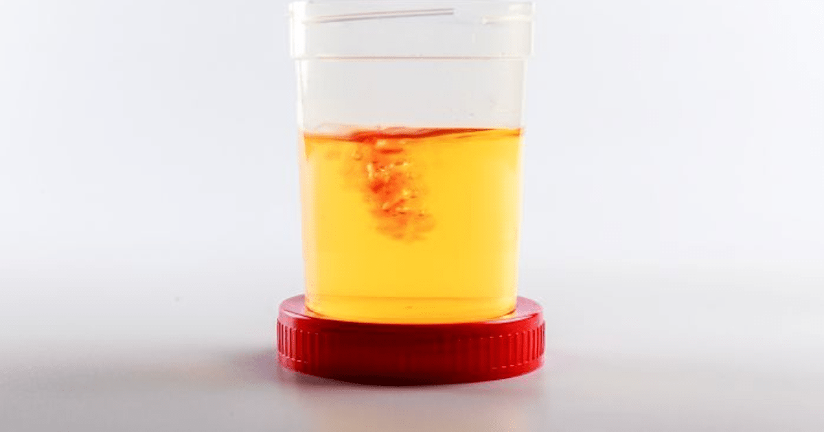 Nu ignora aceste 5 tipuri de sângerare!