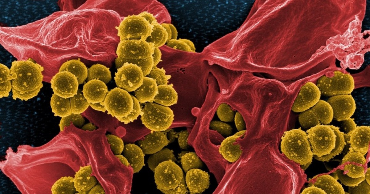 Ce este bine să ştii despre stafilococul auriu | adevarul.ro